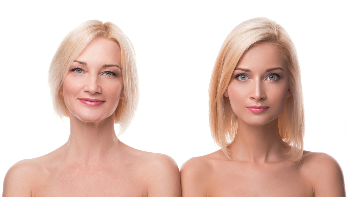 Botox Before and After: Real Results from Patients